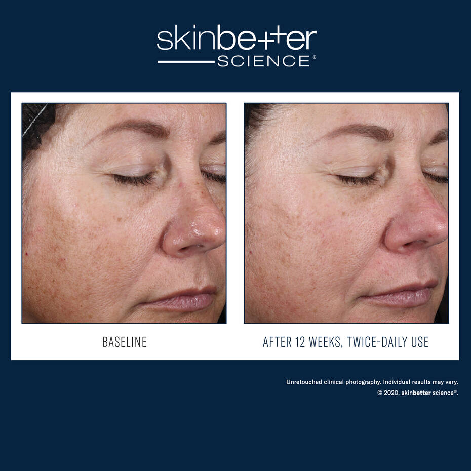 ALTO ADVANCED DEFENSE AND REPAIR SERUM Skinbetter science Canada